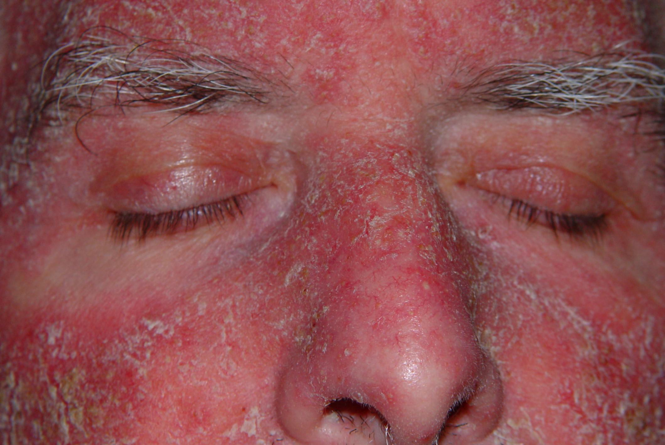 01. DIAGNÓSTICO DERMATOLÓGICO