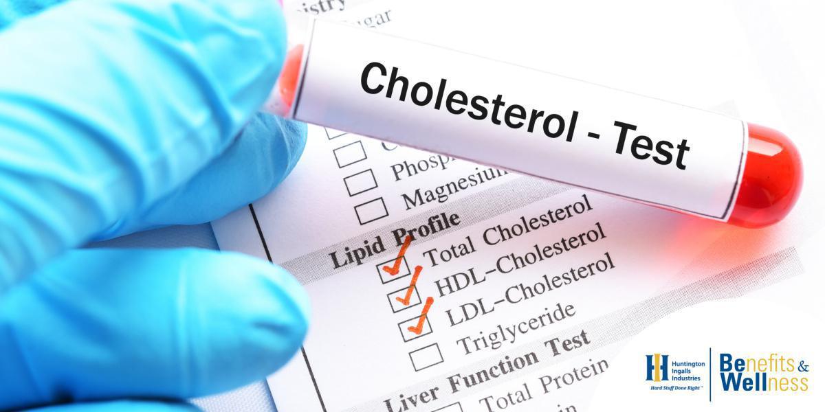 Know Your Numbers Program: Know Your Cholesterol Levels Know Your Numbers Program: Know Your Cholesterol Levels