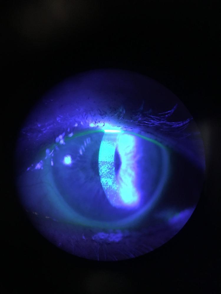 Exceptional Eye Care Made Easy: Call To Schedule With Dr. Wilkins or Dr ...